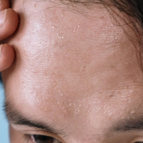 The Solution to Gooch Grease - 100.3 The Bear - Omny.fm