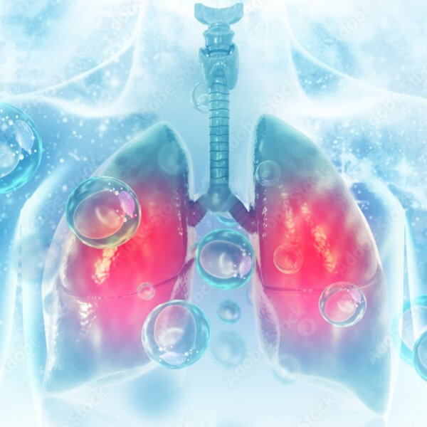 Ep. 17 - Benefici di BioFire Pneumonia plus in AMS, con parte specifica ...